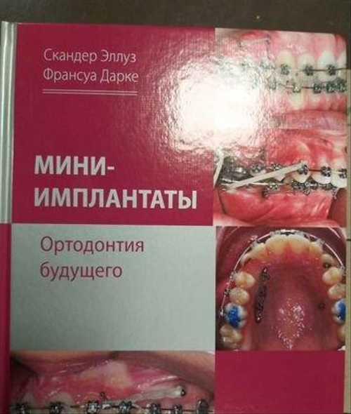 Книги по ортодонтии