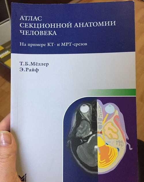 Атлас секционной анатомии. Секционная анатомия Меллер. Секционная анатомия головы. Секционная анатомия кт и мрт.