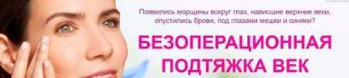 Безоперационная подтяжка век (2020)