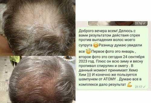 Тоник для роста волос Atomy