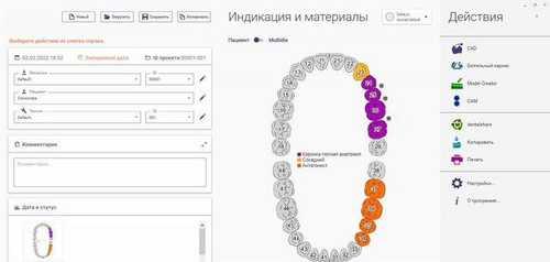 Exocad моделирование Полный комплект