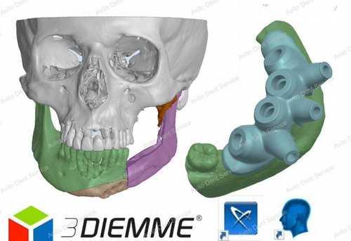 3Diagnosys Plastycad программа