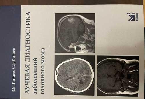 Лучевая диагностика заболеваний головного мозга