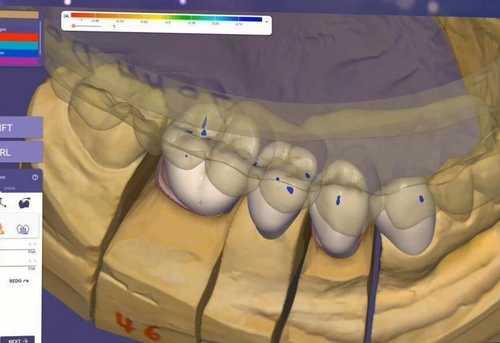 Hyperdent/3shape/ExoCad/Biblioteki Geo/PlastyCad