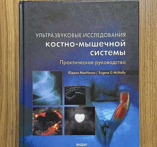 Узи костно-мышечной системы макнелли