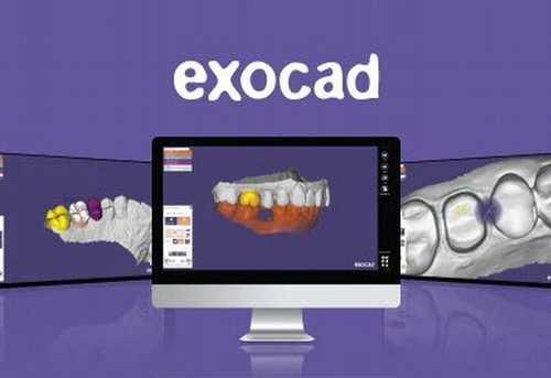 Exocad