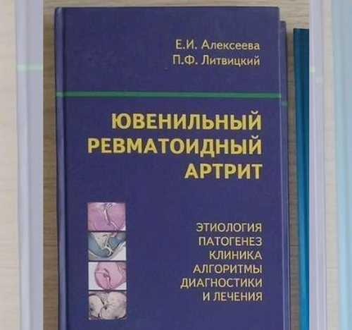 Книга Ювенильный ревматоидный артрит