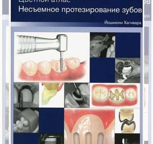 Цветной атлас несъемное протезирование зубов