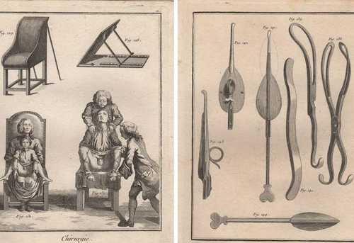 Гравюры.1780г. Хирургия. Медицина. Инструменты. Ч1