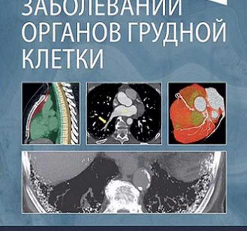 Диагностика заболеваний органов грудной клетки