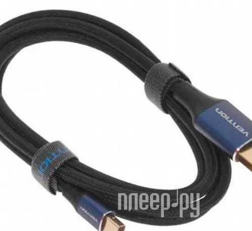 Vention DisplayPort - Mini DisplayPortM 1.5m hcflg