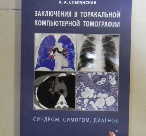 Заключение в торакальной кт.Симптом,синдром,диагно