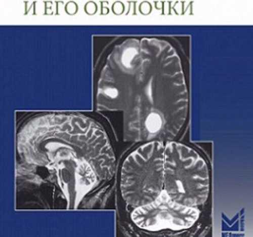 Дифференциальная диагностика в нейровизуализации