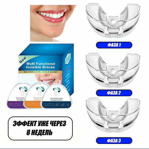 Капа стоматологическая, 3 фазы, трейнер для зубов, правильный прикус, выравнивание зубов
