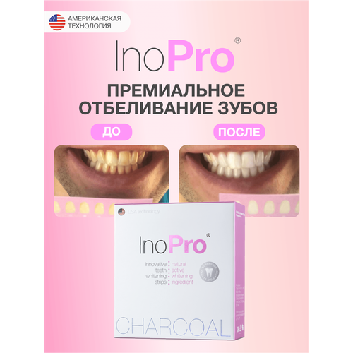 Отбеливающие полоски для зубов InoPro
