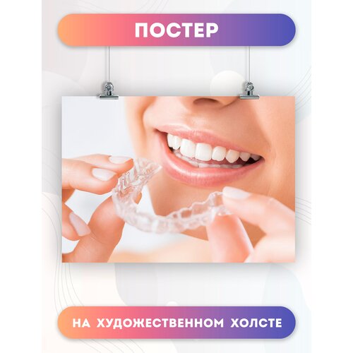 Постер на холсте Стоматология Элайнеры (3) 50х70 см