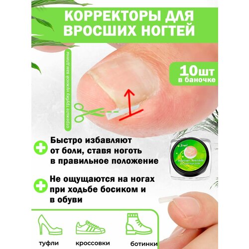 Набор педикюрный от вросшего ногтя QuisLife: Полоски-корректоры для выпрямления ногтей 10 шт