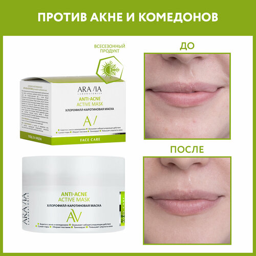 ARAVIA Anti-Acne Active Mask Хлорофилл-каротиновая маска, 177 г, 150 мл