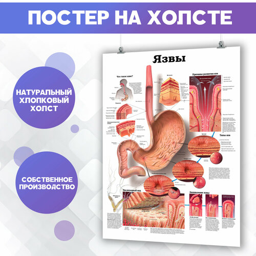 Постер в больницу гастроэнтеролог, анатомия (2) 40х60 см